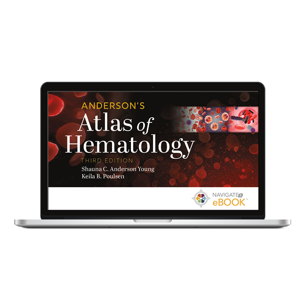 Navigate 2 eBook Access for Anderson's Atlas of Hematology: 9781284210446